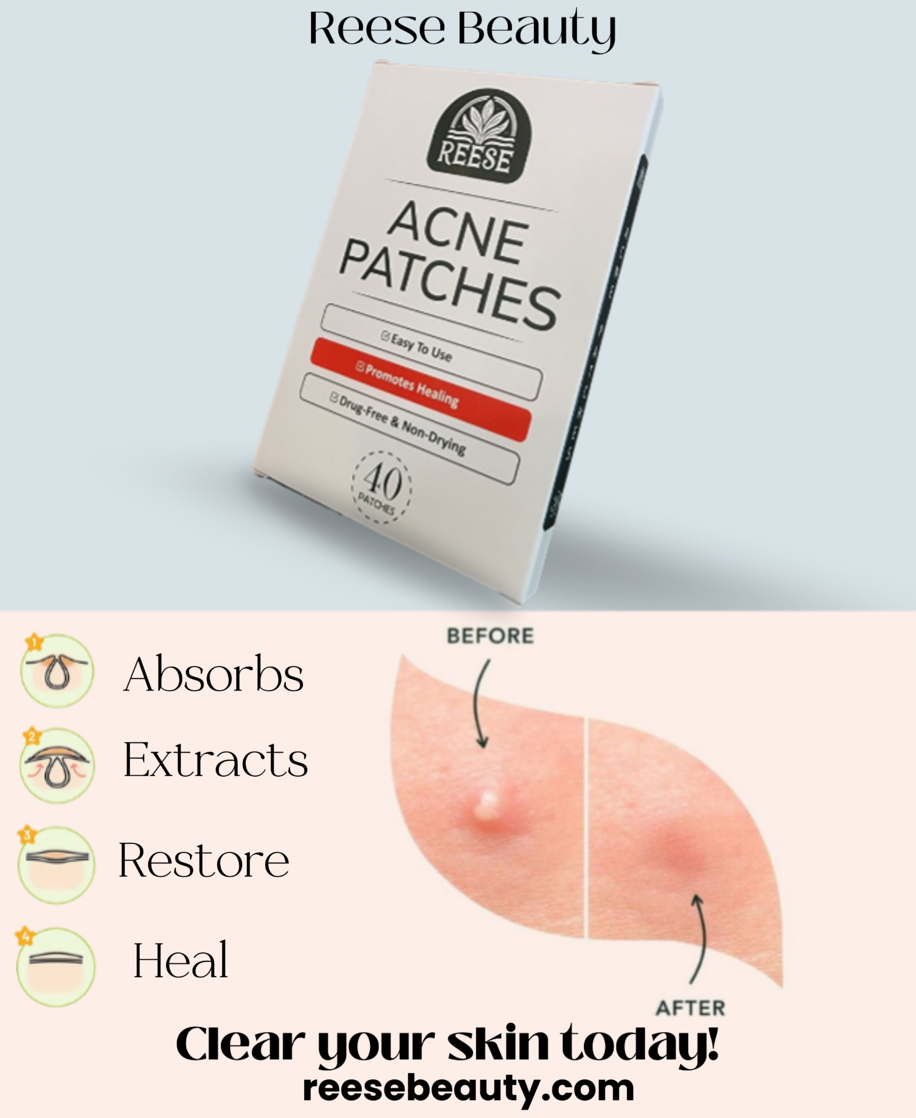 Reese Clear Skin Acne Patches|40 Patches/Box|Fast Healing|Invisible|Hy ...